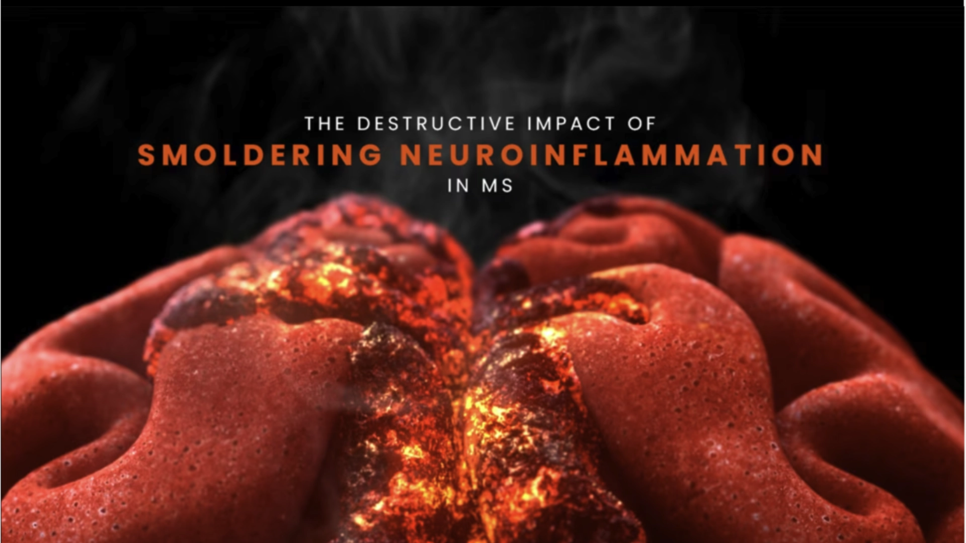 Neuroinfiammazione acuta e smoldering